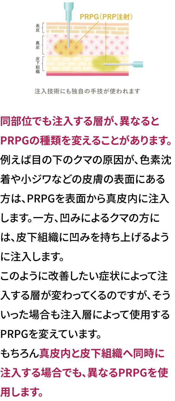 PRP+FGFってリスクはある？ | プルージュ美容クリニック（品川） | PRP美容再生医療専門・美容整形